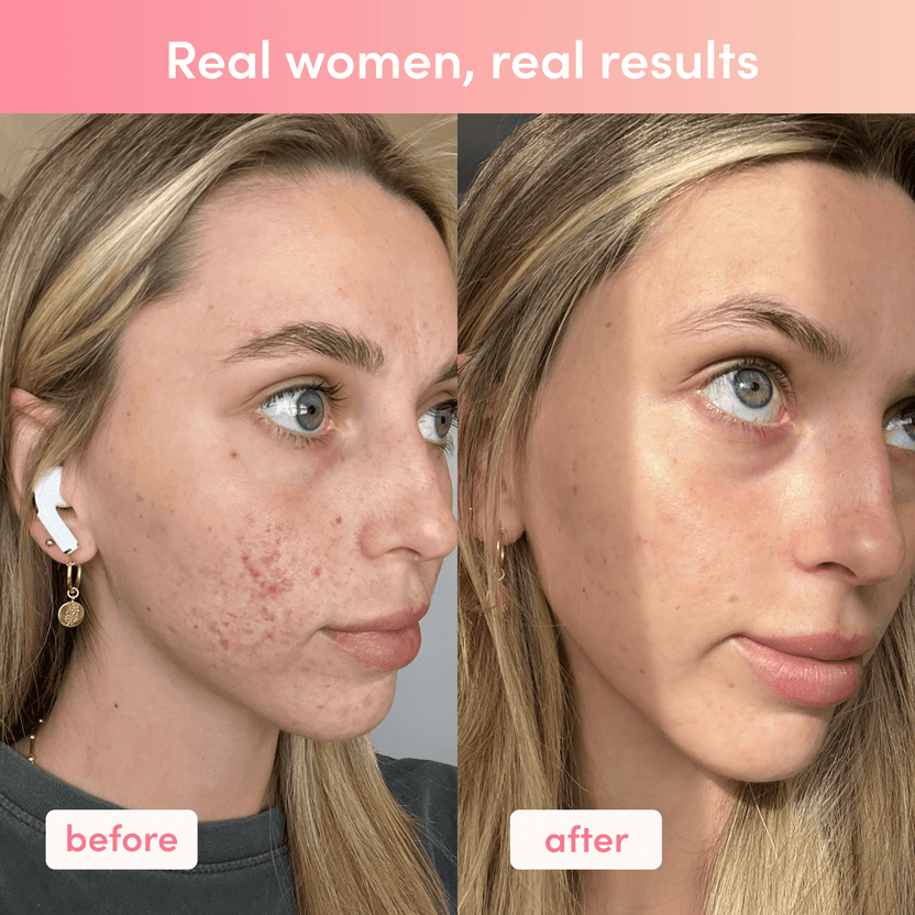 Original Collagen Peptides - Unflavoured 420g | The Collagen Co. – The ...